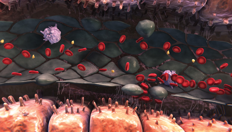 Defitelio® (defibrotide sodium) | Pathophysiology of VOD/SOS